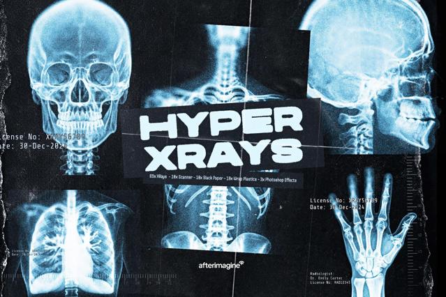 Hyper XRays Collection